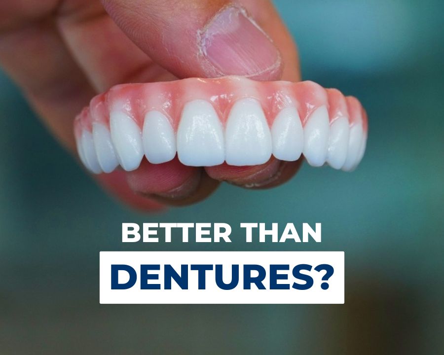 Are Dental Implants Actually a Permanent Fix?